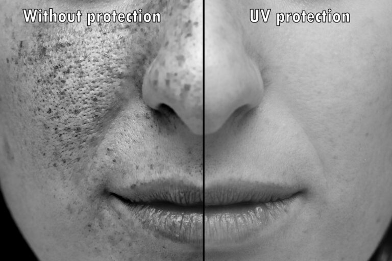 Sunbed Dangers vs Safe Tanning | Beautyrokz Spray Tan Near Me